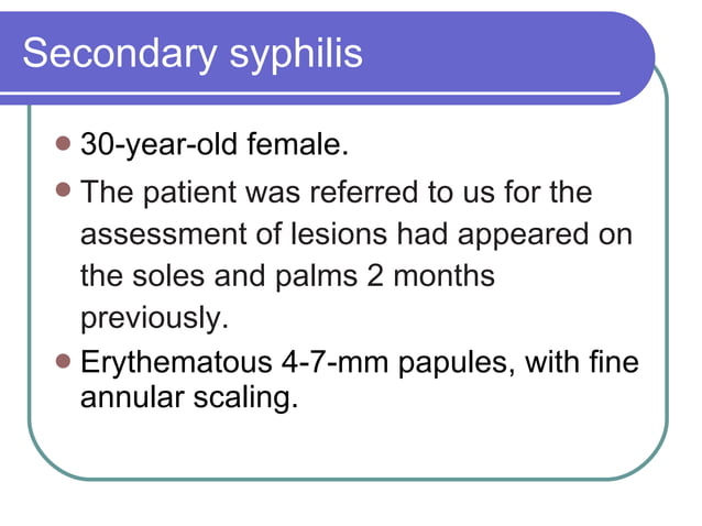 Secondary Syphilis | PPT