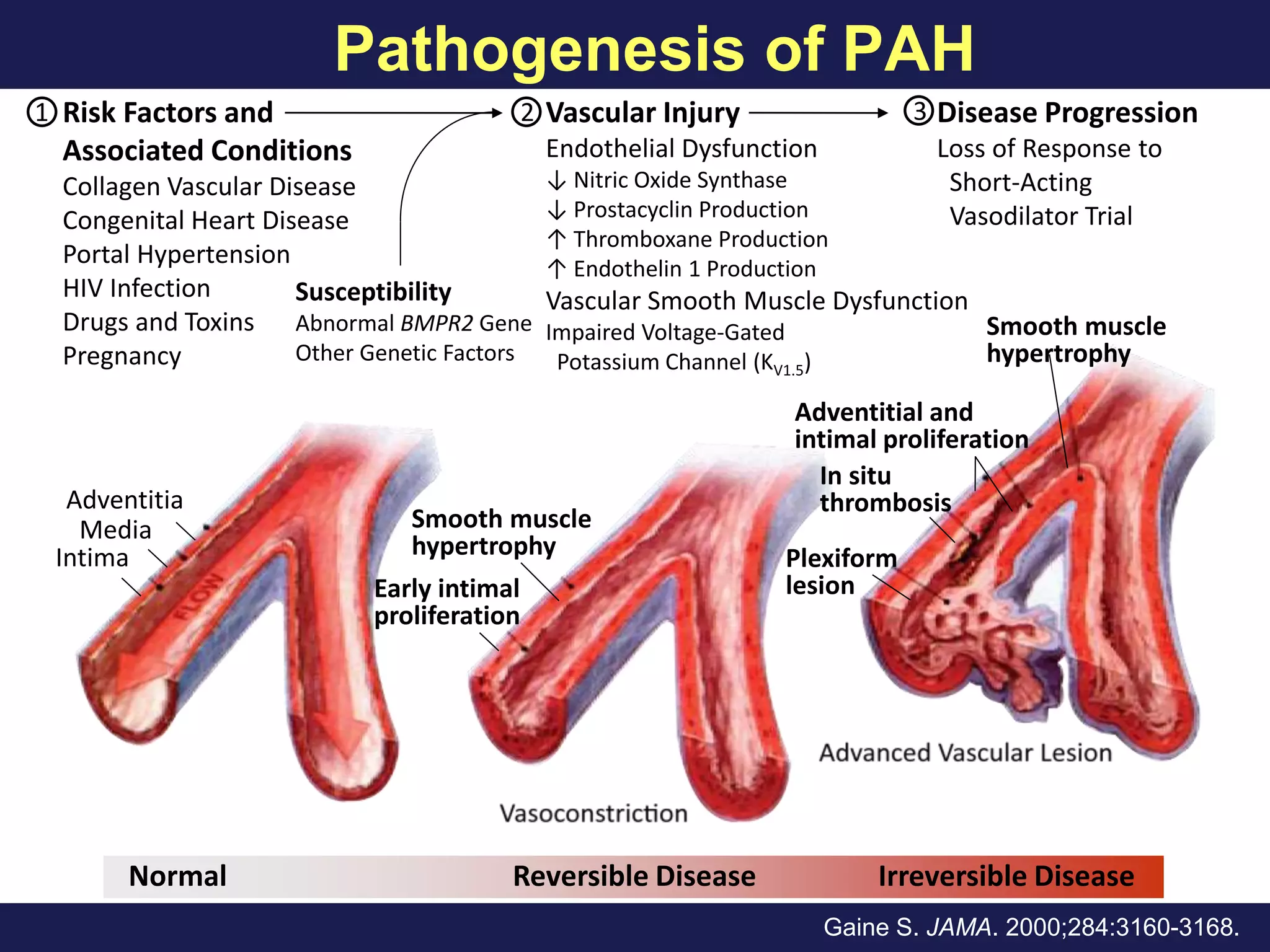 Current diagnosis and management of PAH from cardiologist point of view ...
