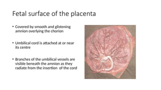 second lectore of IOL according the circullum .pptx