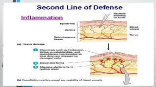 Second line of defense | PPTX