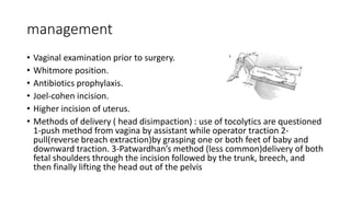 second stage c.s-Dr Ahmed Abdelmotaleb .pptx