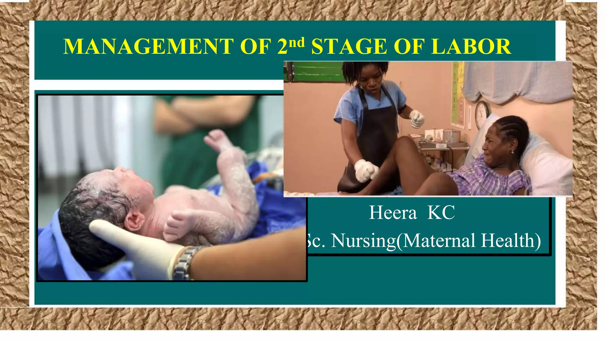 Second stage management of labour | PPTX