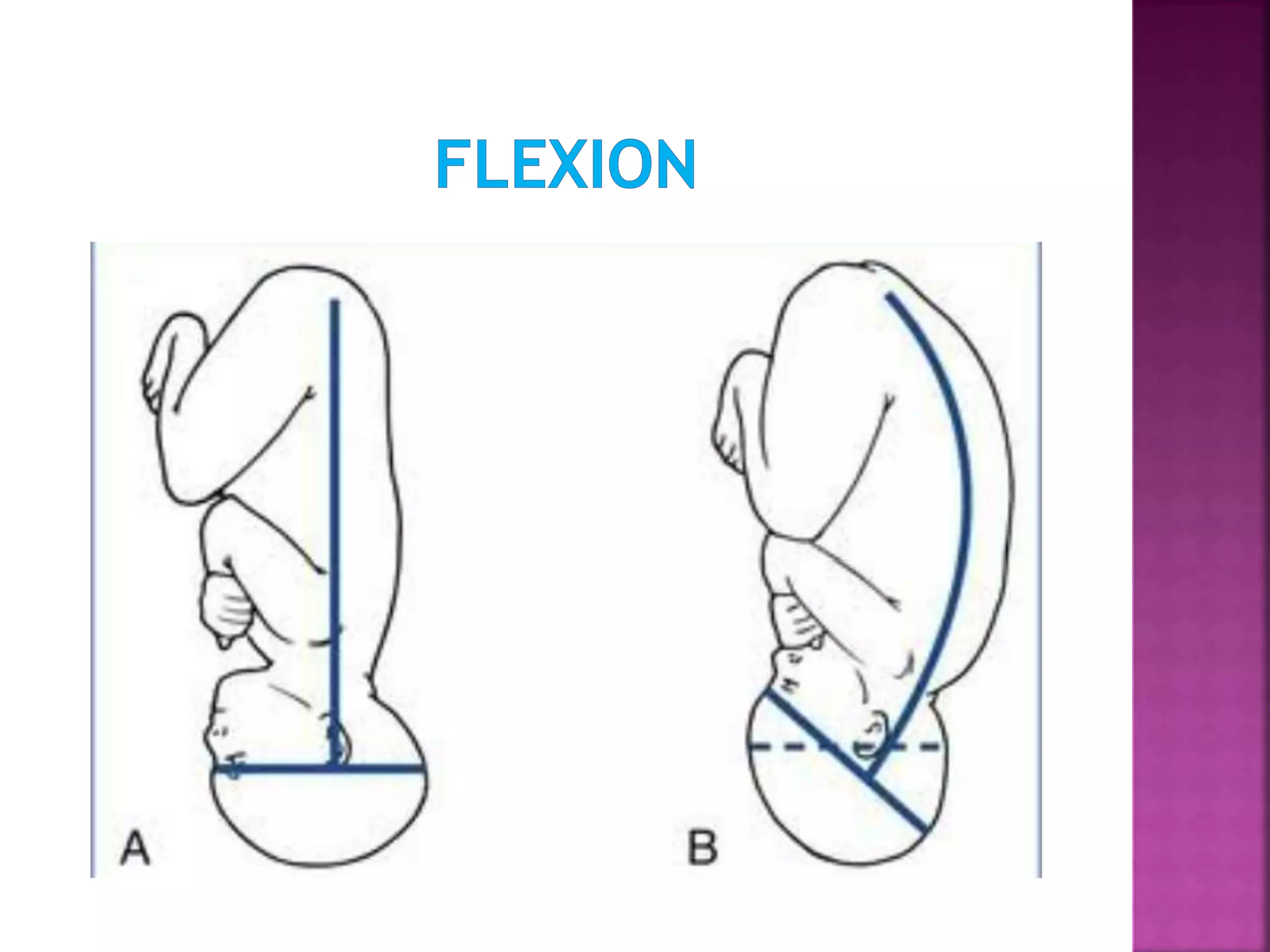 Second stage of labour | PPTX