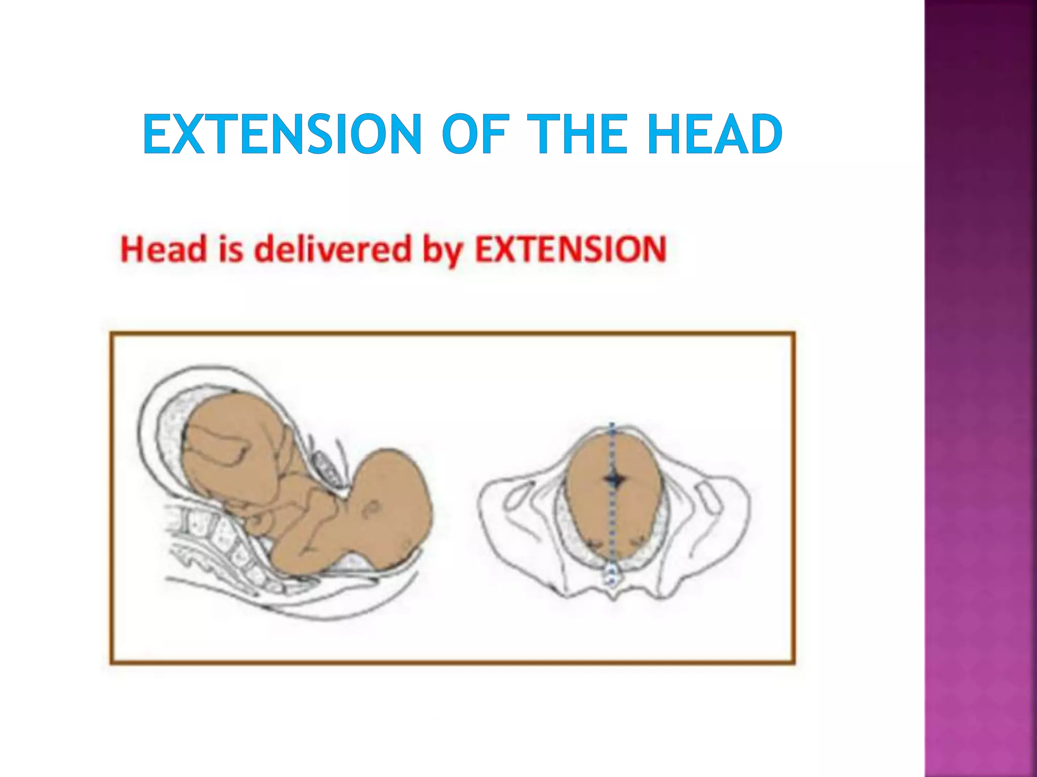 Second stage of labour | PPTX