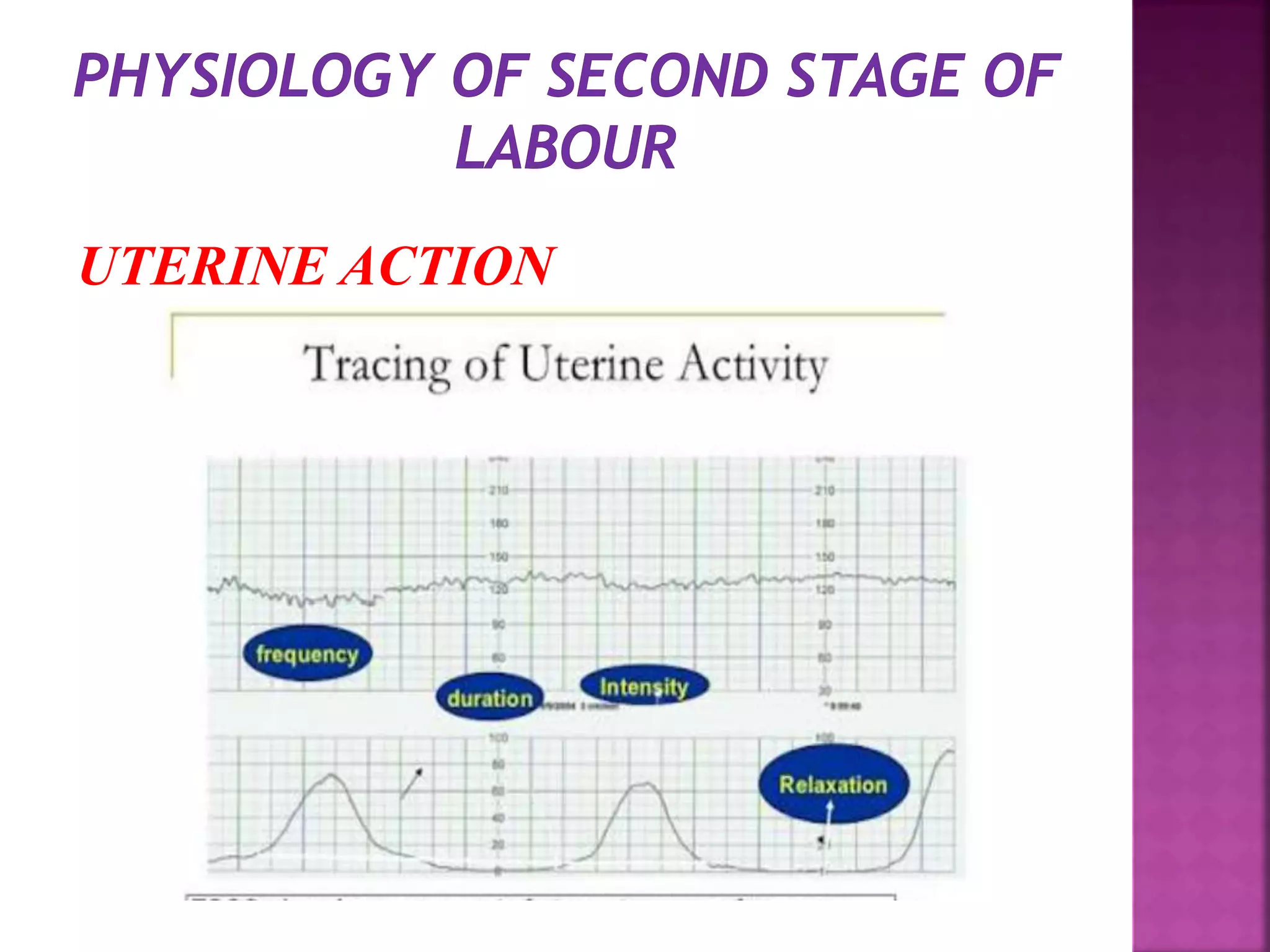 Second stage of labour | PPTX
