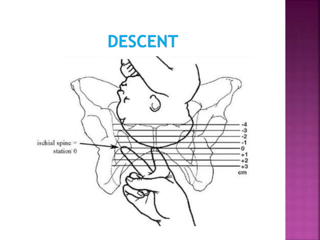 Second stage of labour | PPTX
