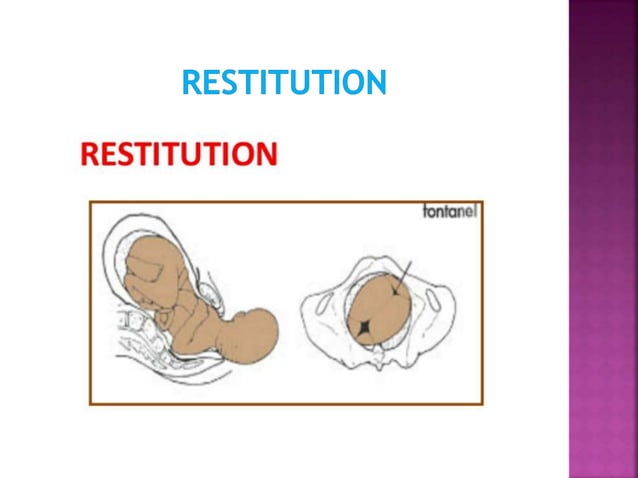 Second stage of labour | PPTX