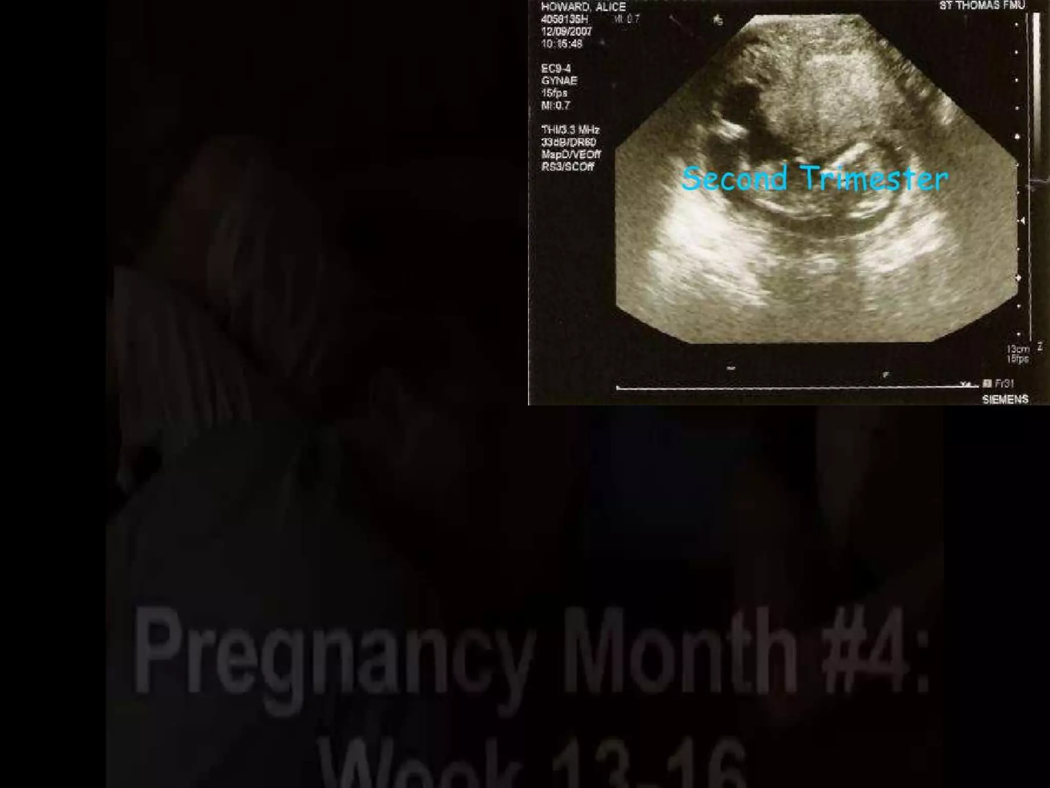 Second trimester OF PREGNANCY | PPTX