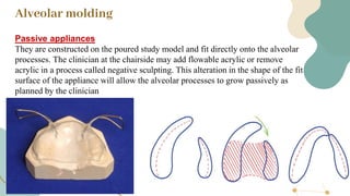 Cleft lip and palate and prosthesis neonates | PDF