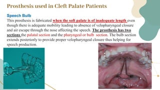 Cleft lip and palate and prosthesis neonates | PPT