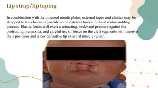 Cleft lip and palate and prosthesis neonates | PPT