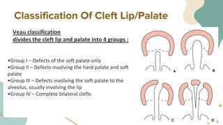 Cleft lip and palate and prosthesis neonates | PPT