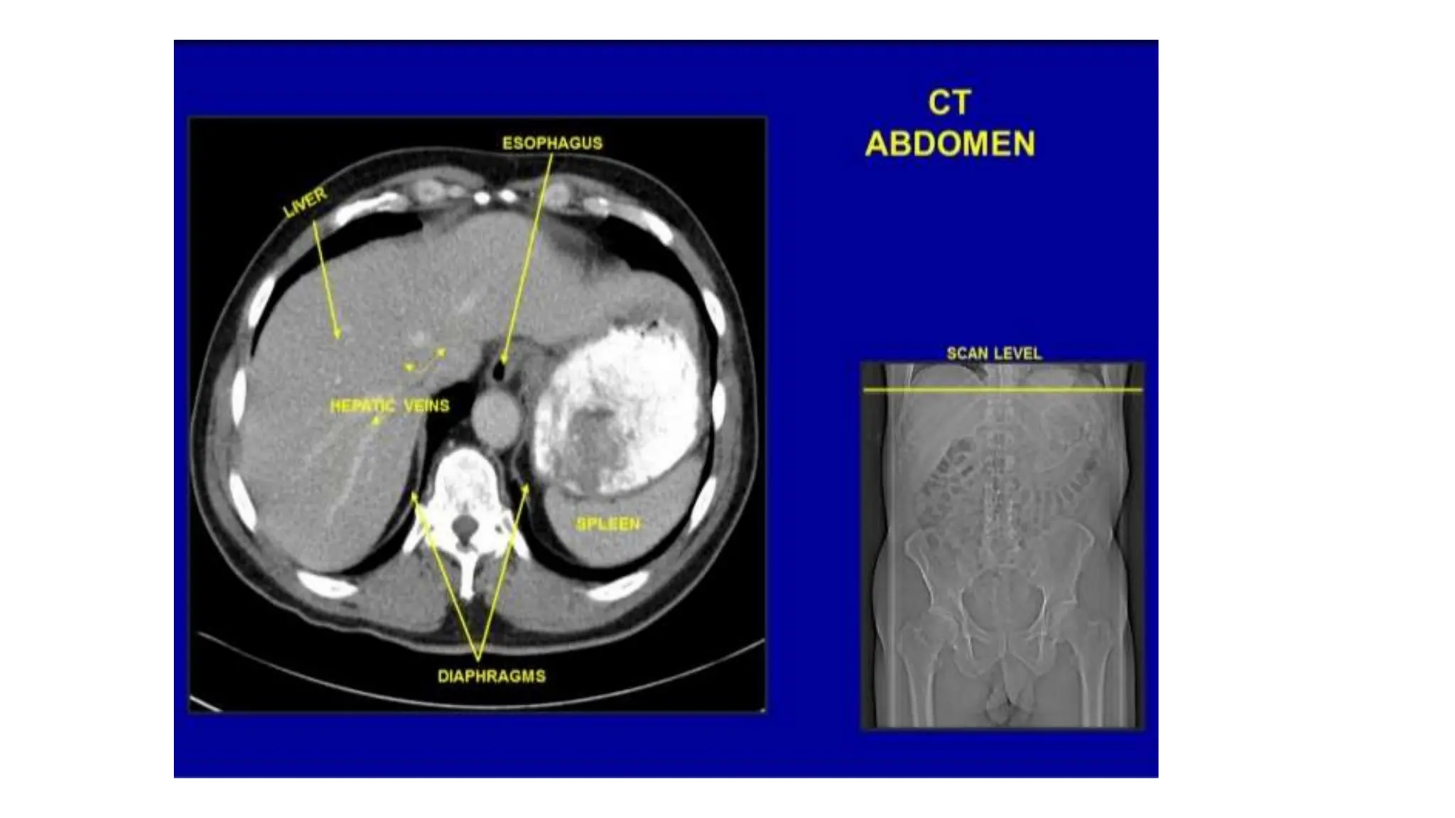 Section 1 CT Abdomen and Pelvis by doctor Aya Ali Taha | PPTX