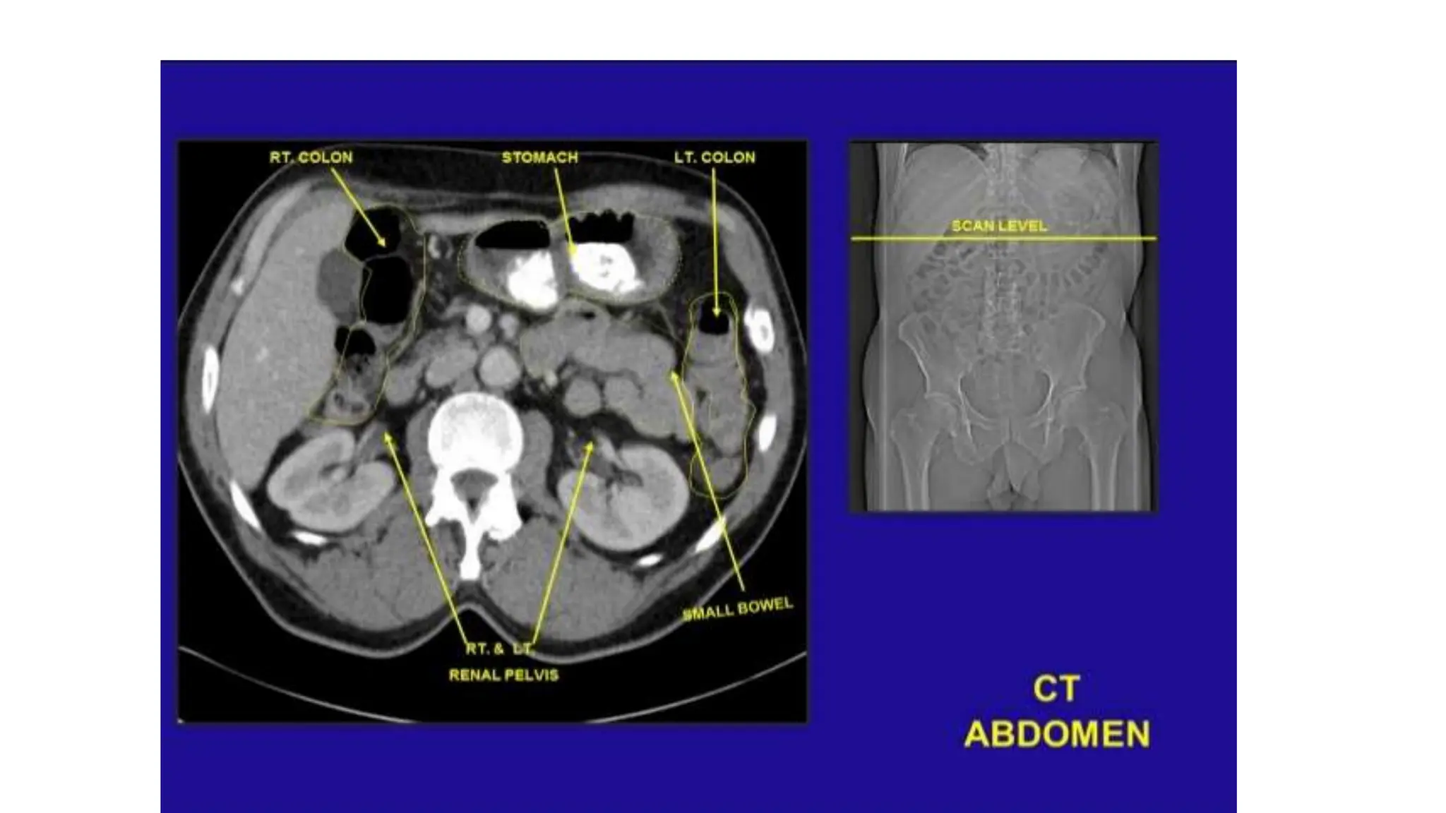 Section 1 CT Abdomen and Pelvis by doctor Aya Ali Taha | PPTX