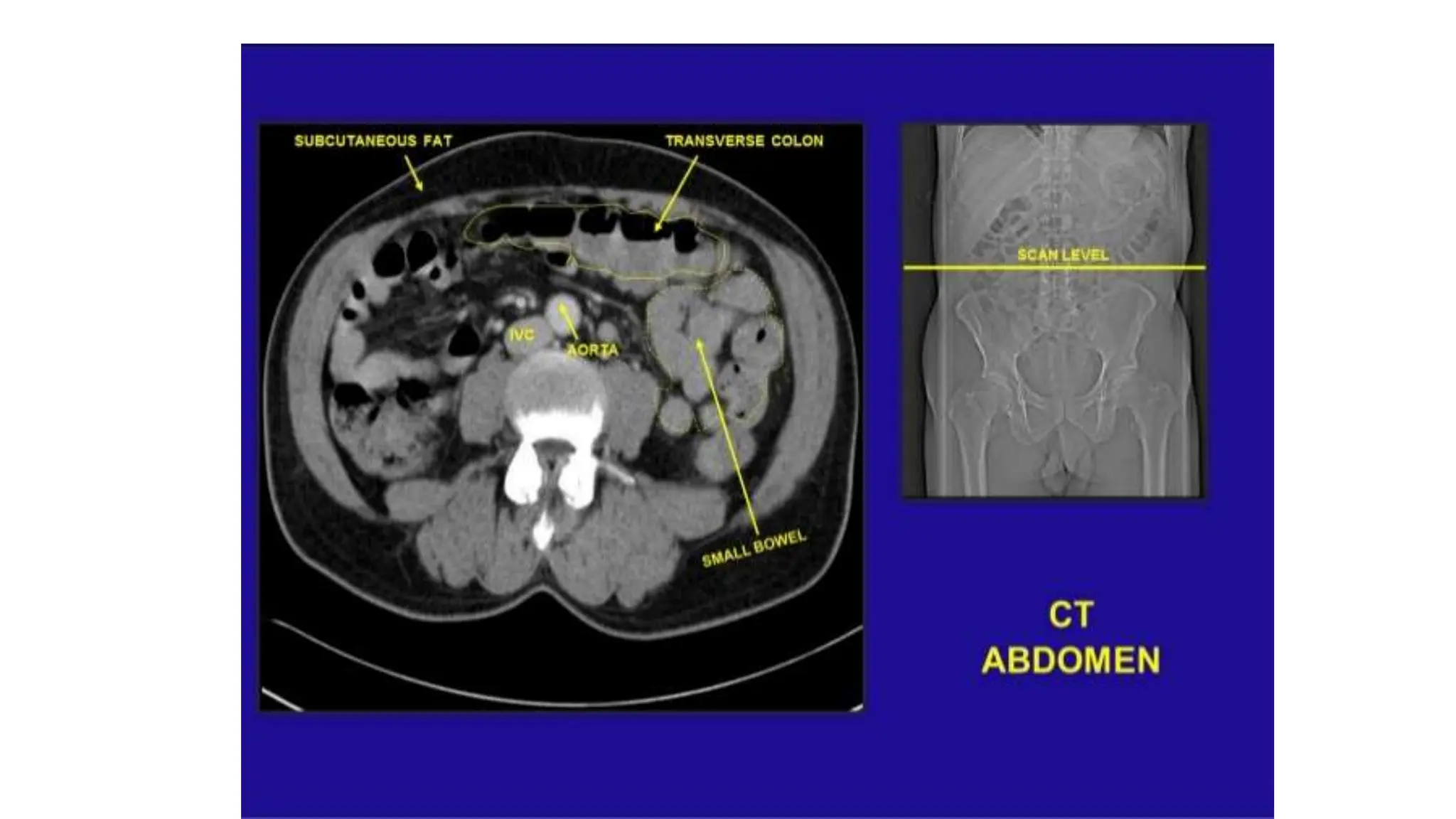 Section 1 CT Abdomen and Pelvis by doctor Aya Ali Taha | PPTX