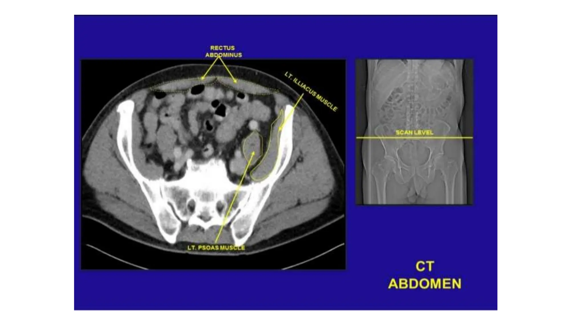Section 1 Ct Abdomen And Pelvis By Doctor Aya Ali Taha Ppt