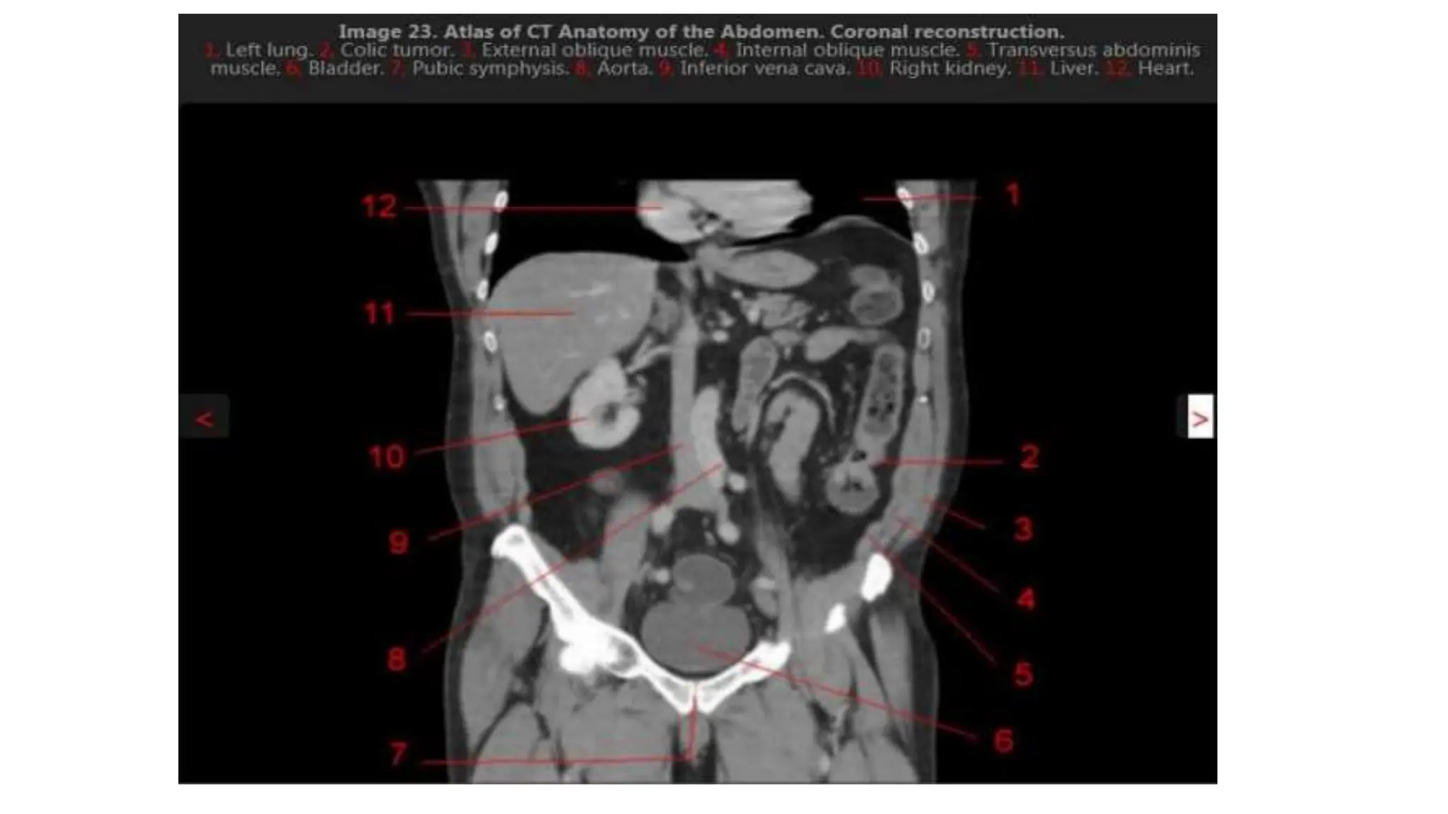Section 1 CT Abdomen and Pelvis by doctor Aya Ali Taha | PPTX