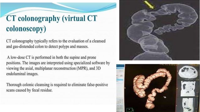 Section 1 CT Abdomen and Pelvis by doctor Aya Ali Taha | PPT