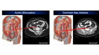 Section 1 CT Abdomen and Pelvis by doctor Aya Ali Taha | PPTX