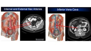 Section 1 CT Abdomen and Pelvis by doctor Aya Ali Taha | PPTX