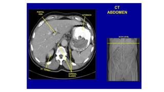 Section 1 CT Abdomen and Pelvis by doctor Aya Ali Taha | PPTX