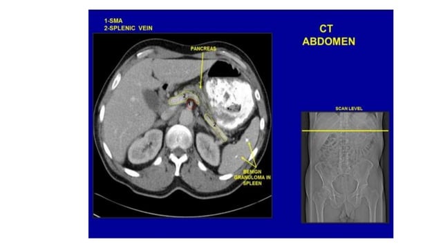 Section 1 CT Abdomen and Pelvis by doctor Aya Ali Taha | PPT