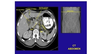 Section 1 CT Abdomen and Pelvis by doctor Aya Ali Taha | PPTX