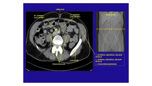 Section 1 CT Abdomen and Pelvis by doctor Aya Ali Taha | PPT