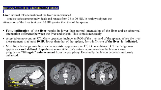 Section 1 CT Abdomen and Pelvis by doctor Aya Ali Taha | PPT