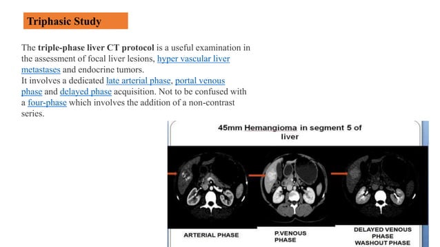 Section 1 CT Abdomen and Pelvis by doctor Aya Ali Taha | PPT