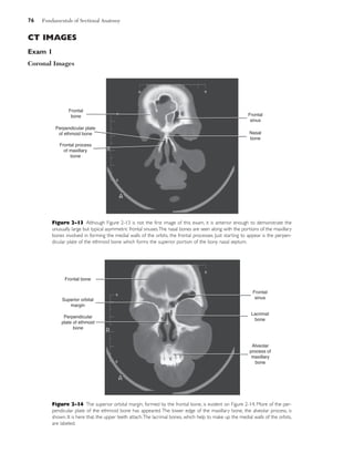 Sectional anatomy | PDF