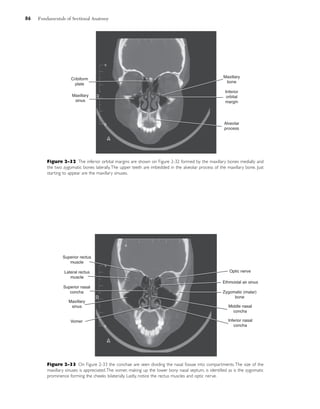 Sectional anatomy | PDF