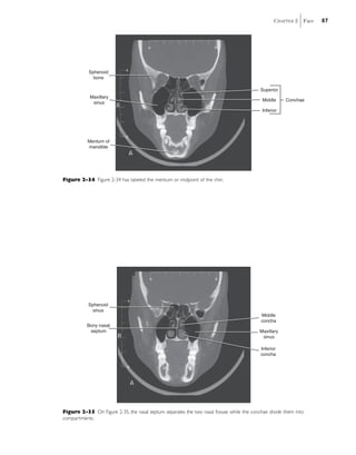 Sectional anatomy | PDF