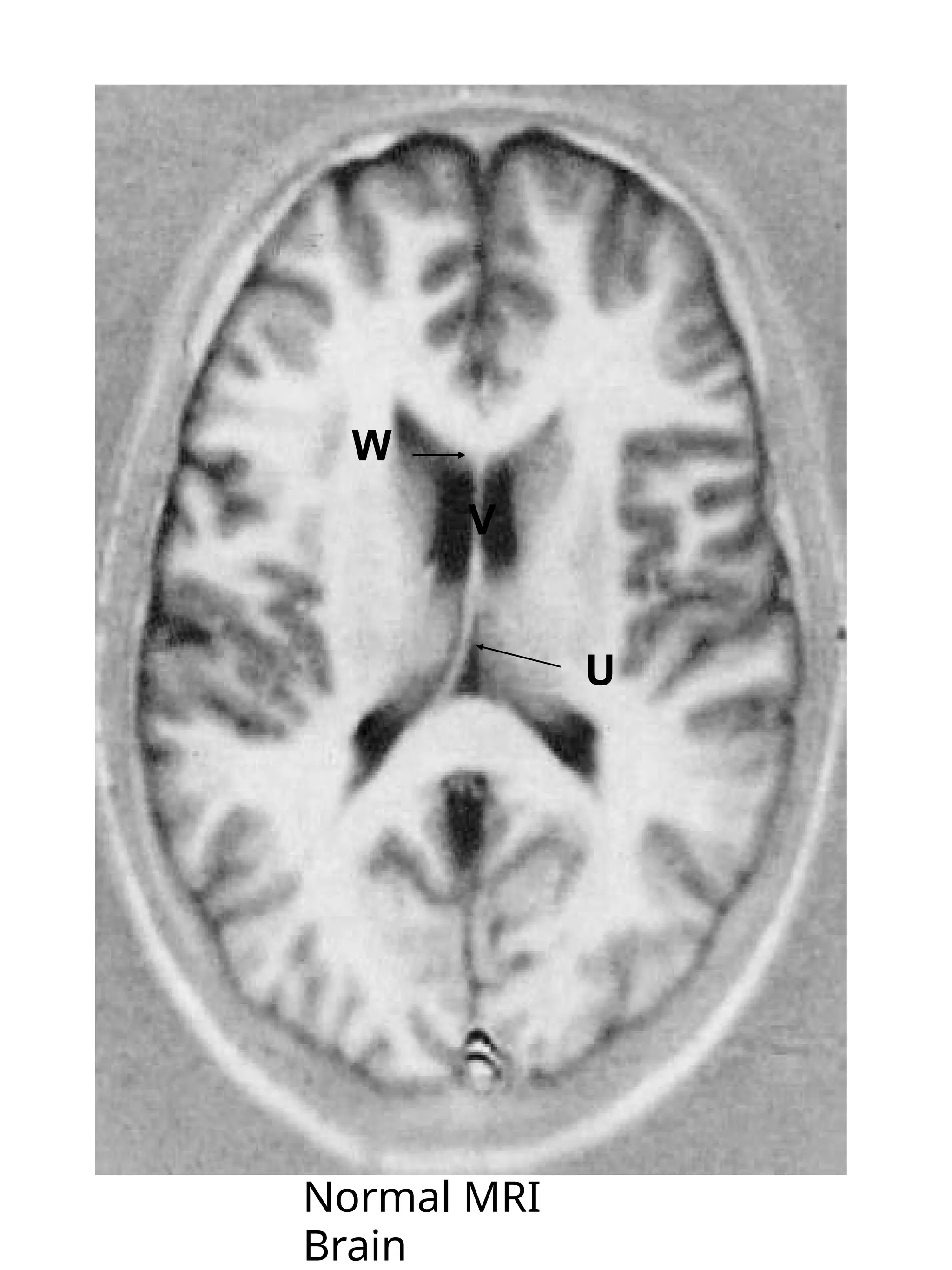 SECTIONAL ANATOMY -ASSESSMERNT 2019mi10.pptx