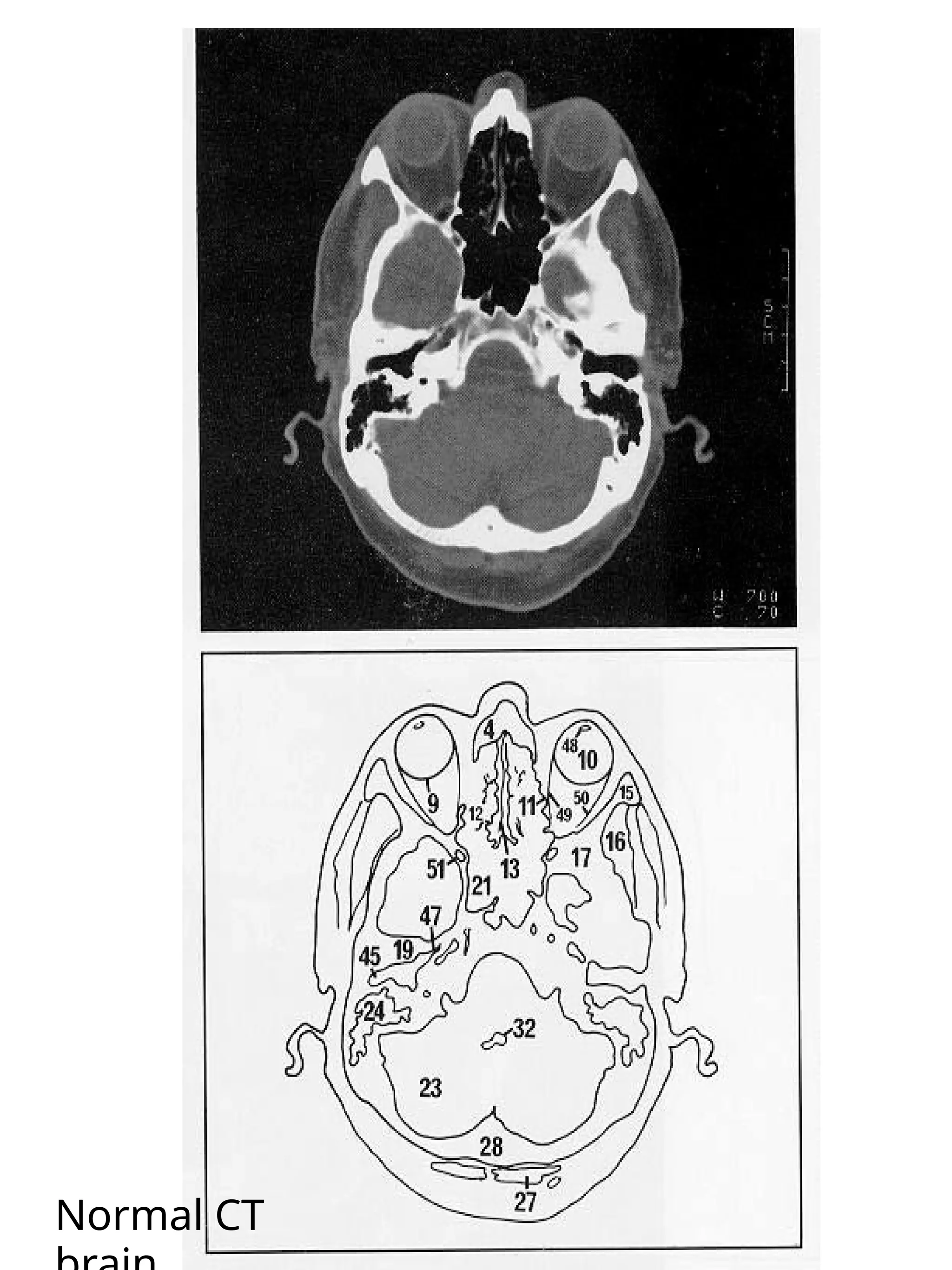 SECTIONAL ANATOMY -ASSESSMERNT 2019mi10.pptx