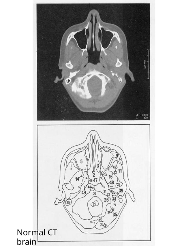SECTIONAL ANATOMY -ASSESSMERNT 2019mi10.pptx