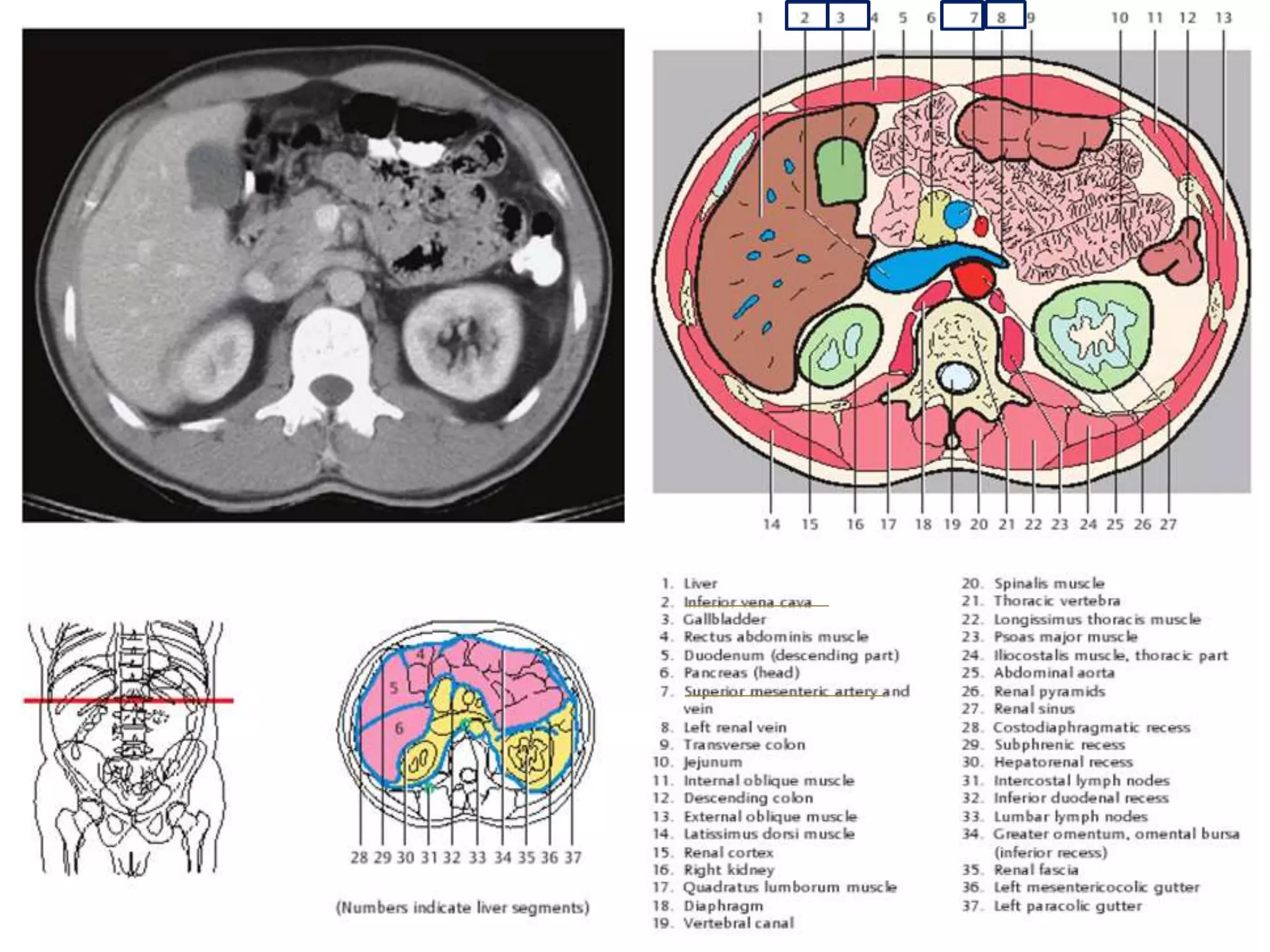 Sectional anatomy of abdomen | PPTX