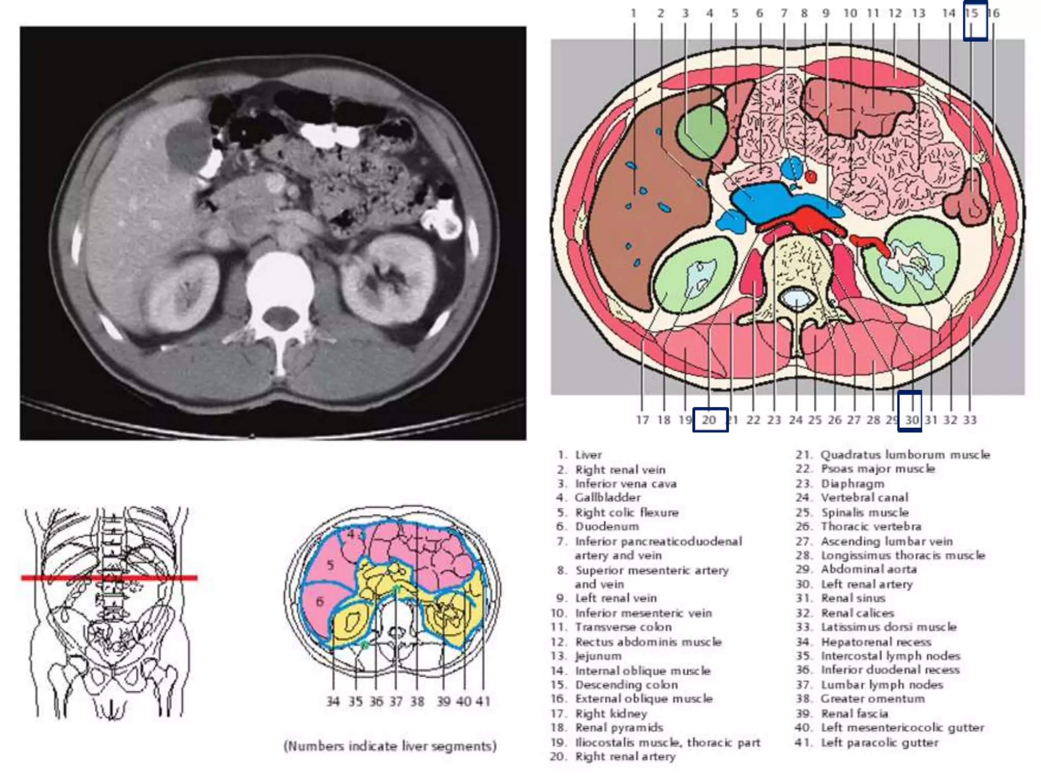 Sectional anatomy of abdomen | PPTX