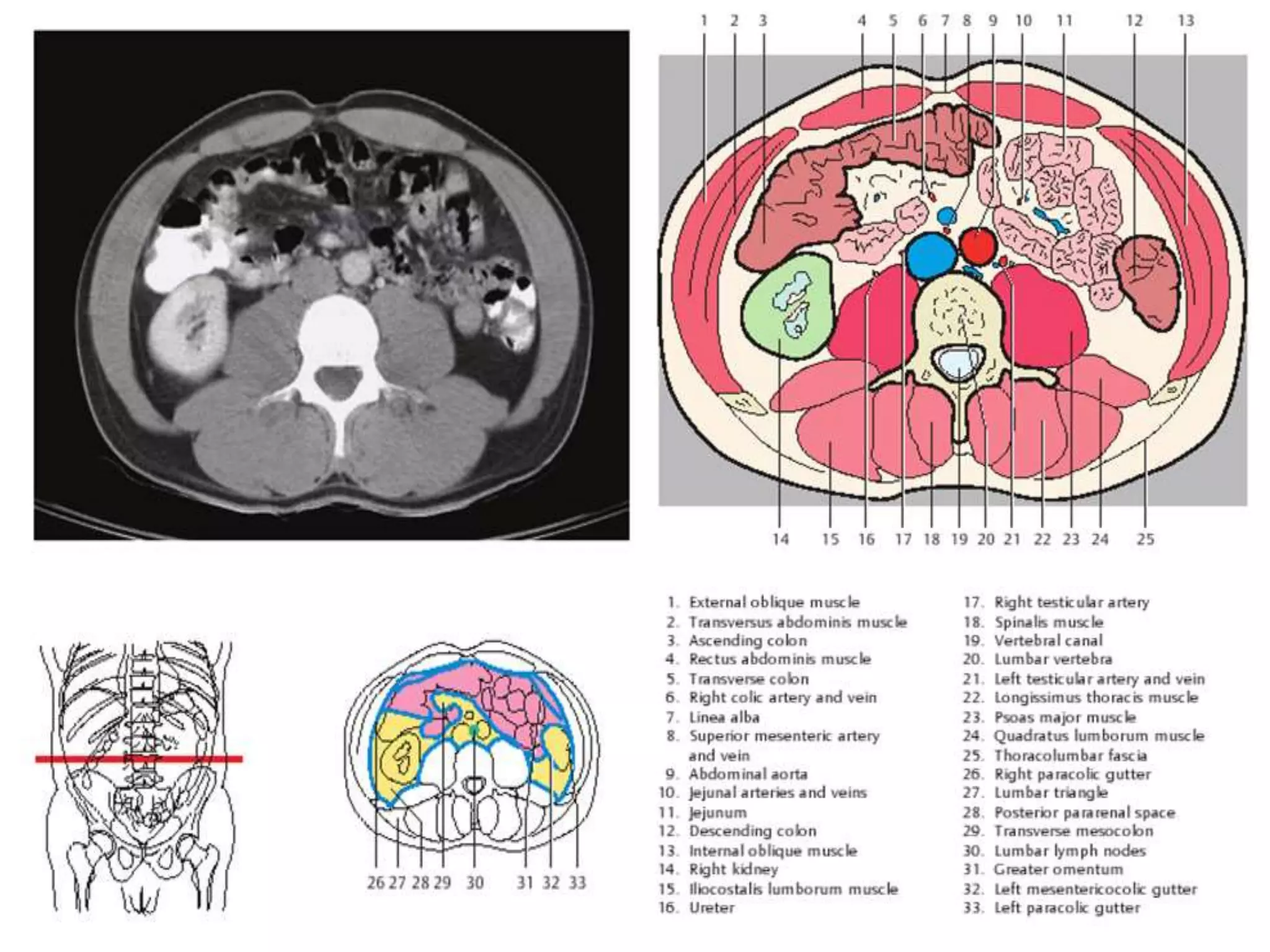 Sectional anatomy of abdomen | PPTX