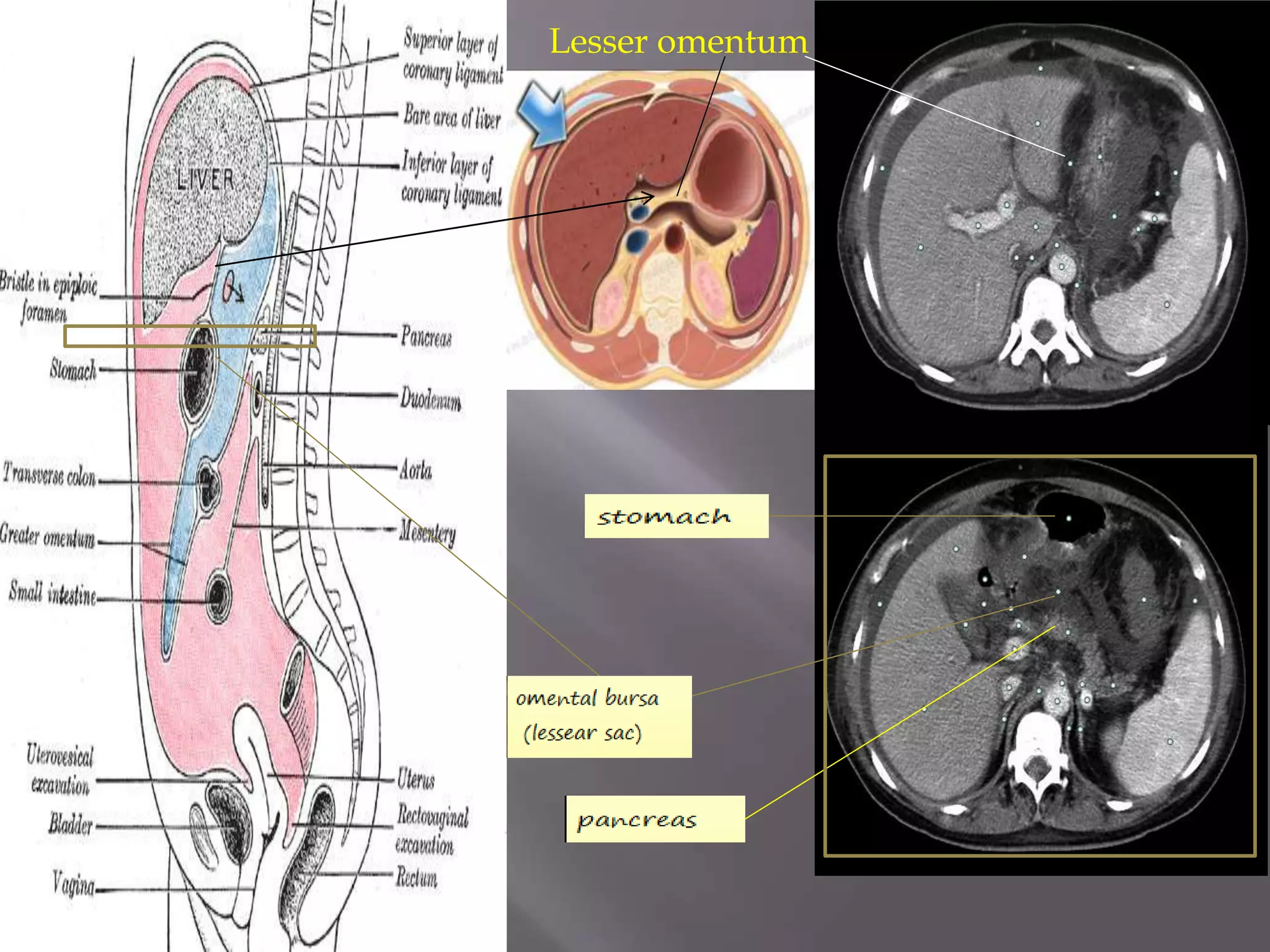 Sectional anatomy of abdomen | PPTX