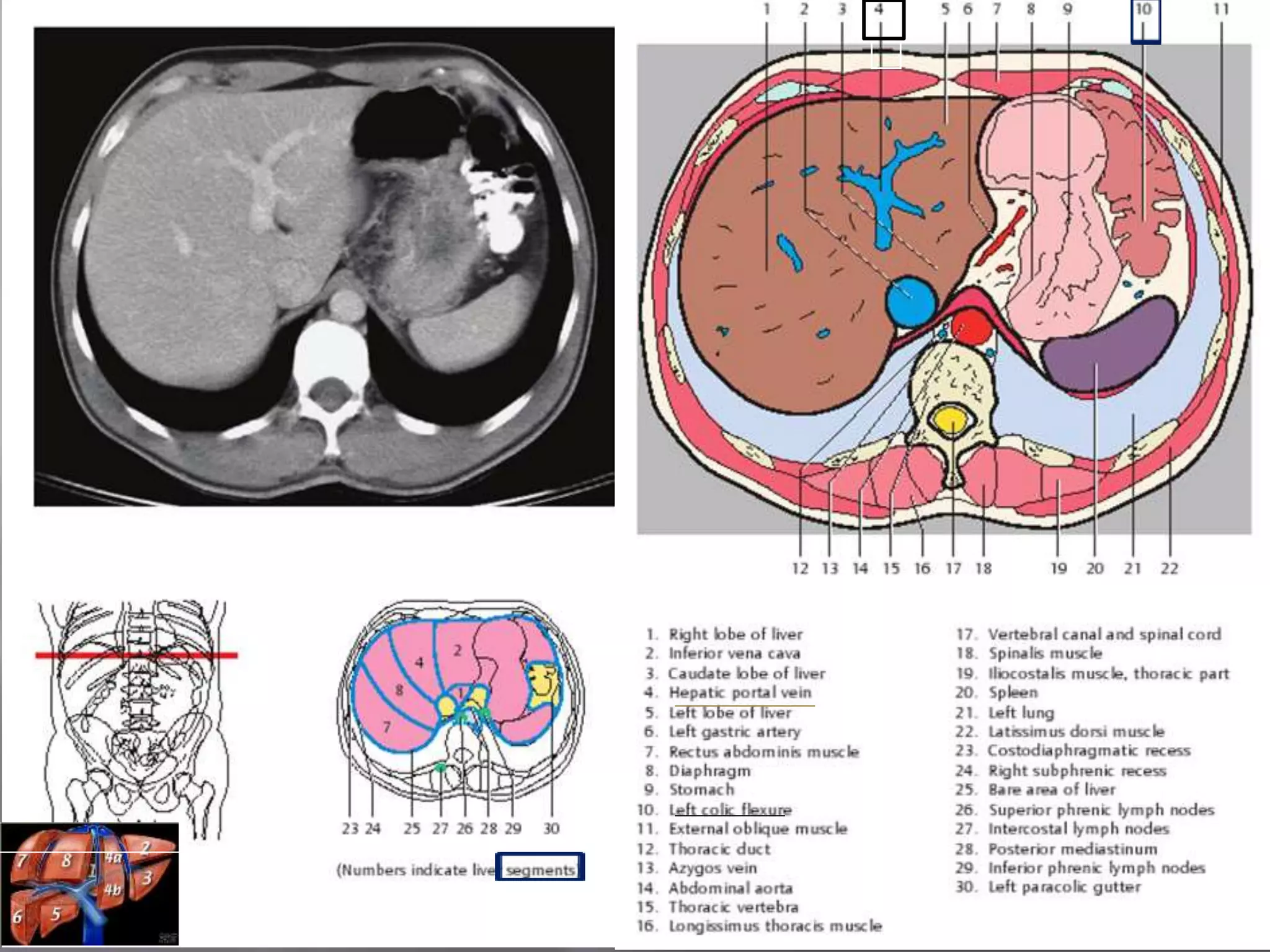 Sectional anatomy of abdomen | PPTX