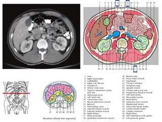Abdominal Wall Anatomy Cross Section