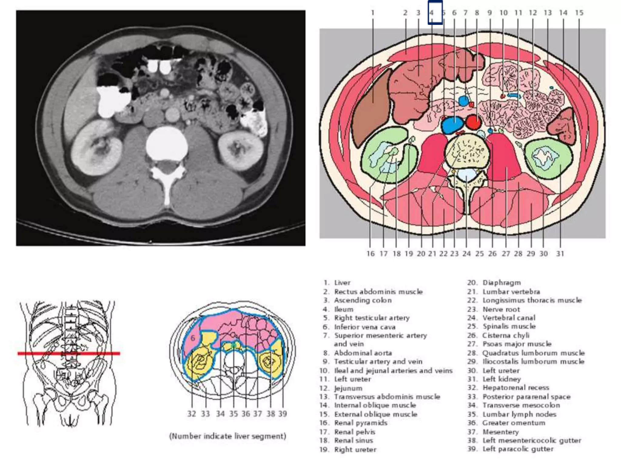 Sectional radio-anatomy of abdomen | PPTX