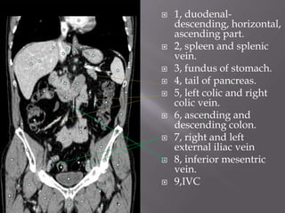 Sectional radio-anatomy of abdomen | PPTX