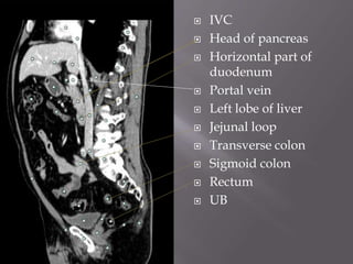 Sectional radio-anatomy of abdomen | PPTX
