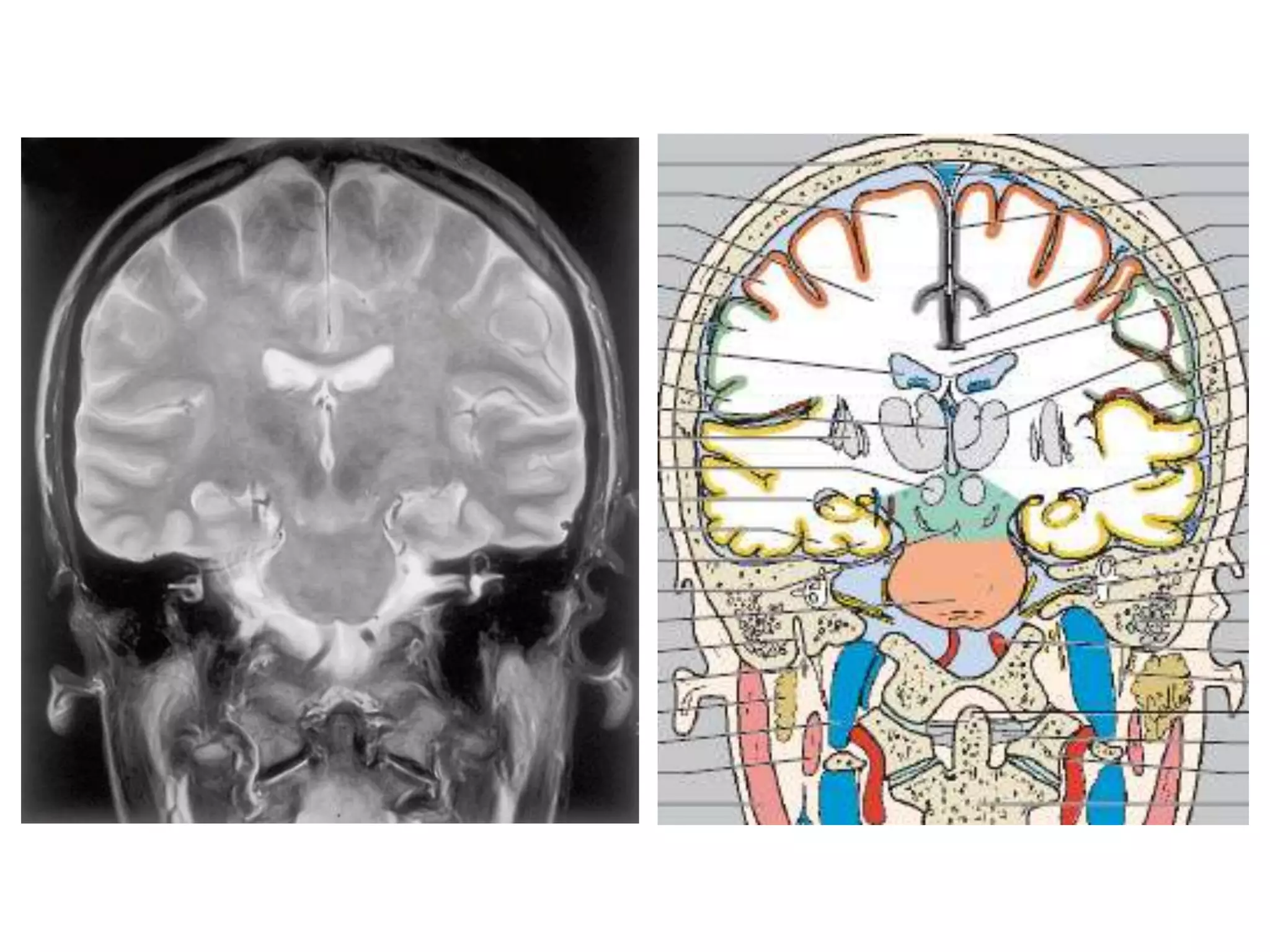 Sectional anatomy of brain part 1 | PPTX