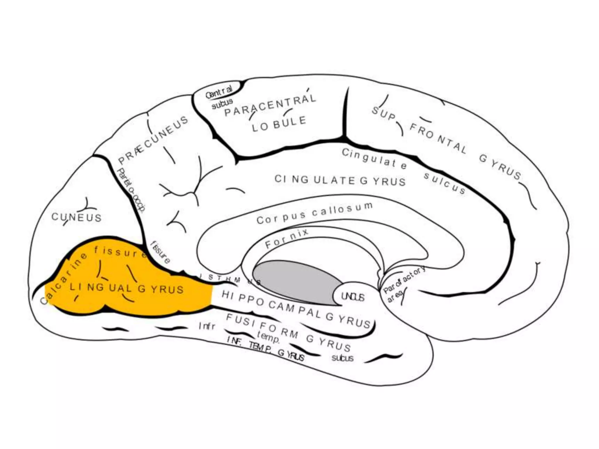 Sectional Anatomy Of Brain Part 1 Ppt 