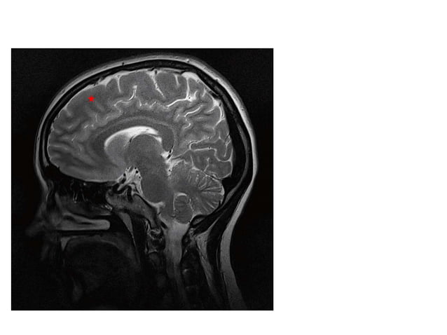 Sectional anatomy of brain part 1 | PPT