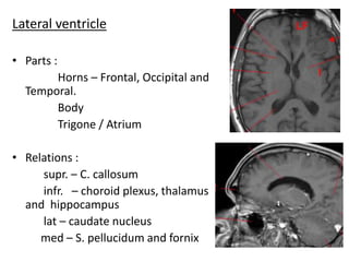 Sectional anatomy of brain part 1 | PPTX