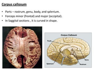 Imaging sectional anatomy of brain part 2 | PPTX